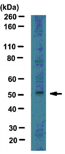 Anti-LMX-1 Antibody | AB10533